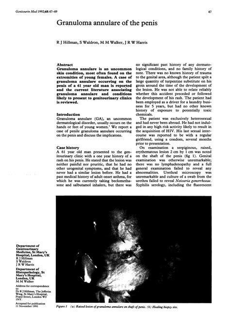 Granuloma Annulare Of The Penis Pmc