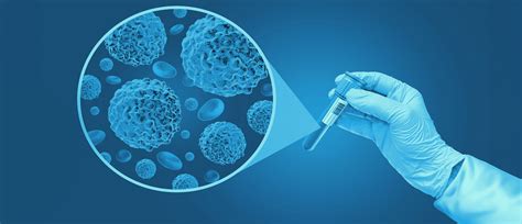 Biomarker Discovery Avance Biosciences