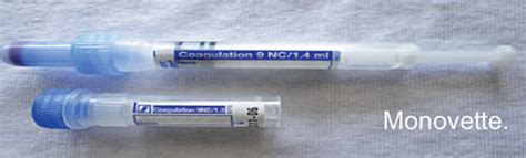 sample collection and handling ch 15 flashcards quizlet