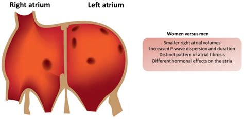 The Pathophysiology Of Sex Differences In Stroke Risk And Prevention In Atrial Fibrillation A