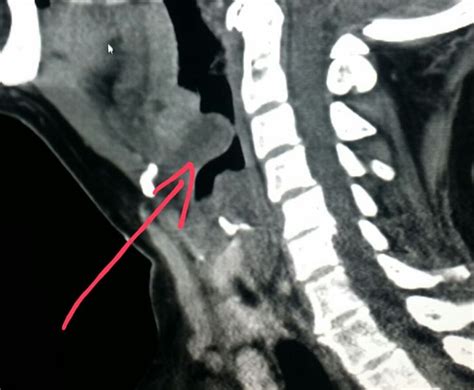 368 Best Ct Scans Images On Pinterest