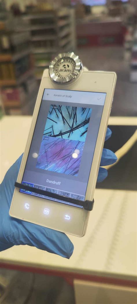 Scalp Inflammation R Dermatologyquestions