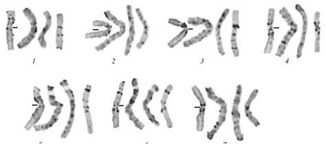 A Karyogram Of H Vulgaris Chromosomes In Each Group Chromosomes Are