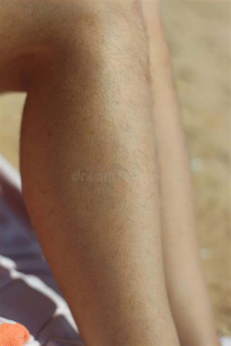 On A Beach In Greece A Woman Proudly Displays Her Natural Hairy Legs