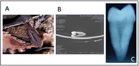 Figure 3 From Finite Element Analysis In Dentistry Improving The