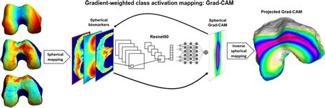 we used the grad cam model interpretation technique to obtain a class