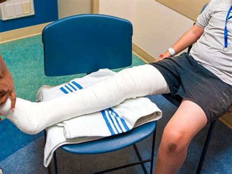 Broken Ankle Cast Blue