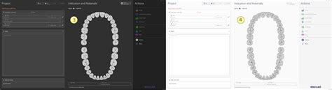 Exocad Wiki File RegistrazioneModelliExocadIta Exocad