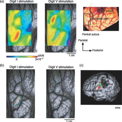 Intrinsic Optical Responses Induced By Digit I And V Stimulation A Download Scientific
