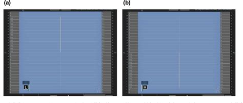 Figure 2 From Performance Of A Multi Leaf Collimator System For Mr‐guided Radiation Therapy