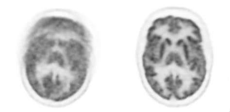 Osama Ammar Msc On Linkedin Medicalimaging Deeplearning Ai Ml