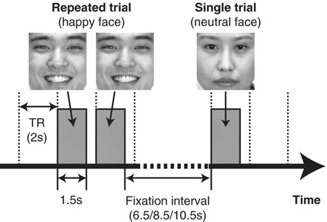 A Schematic Time Course Of The FMRI Experiment Download Scientific Diagram