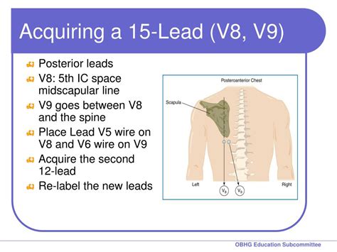 Ppt Chapter 8 For 12 Lead Training The 15 Lead Ecg Powerpoint