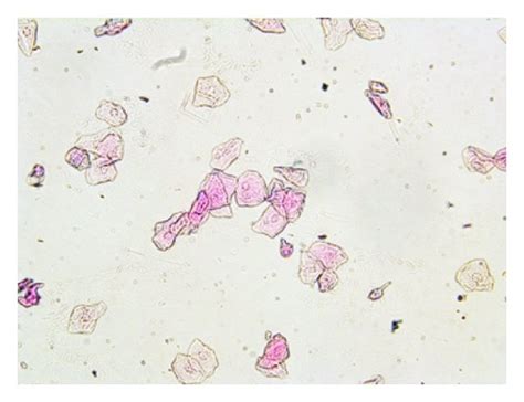 Mice Typical Vaginal Smear Of Different Stages Of The Oestrous Cycle