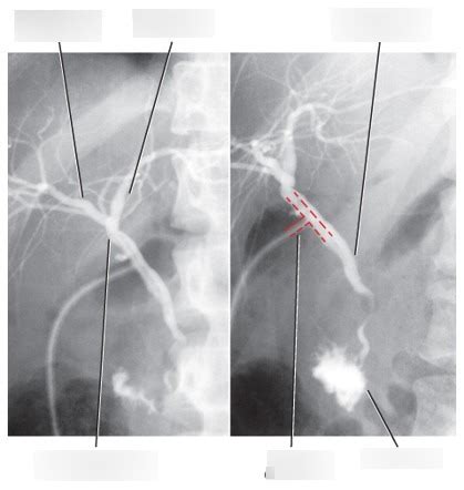 Rad Cholangiogram Anatomy Diagram Quizlet Rad Cholangiogram Anatomy Diagram Quizlet