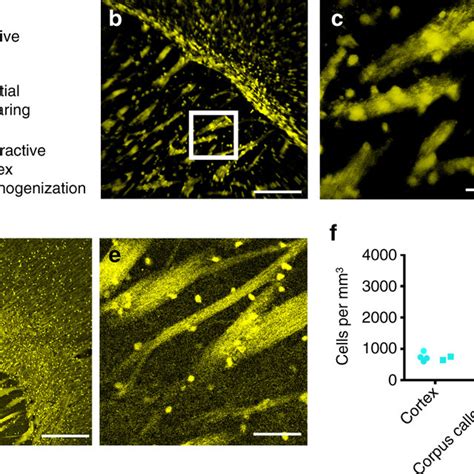 First Order Defocus In Light Sheet Fluorescence Microscopy Lsfm Download Scientific Diagram