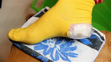 პროცედურა რომელიც 3 დღეში თქვენს ქუსლებს დაუბრუნებს ახალგაზრდულ სინაზესა და სიგლუვეს