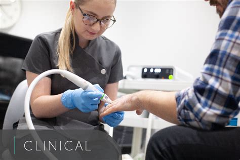Treatment For Warts On Hands Can We Help The Healthcare Hub