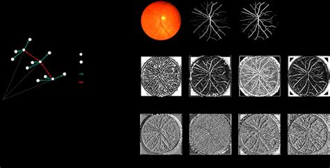 a the relation and intension of response shaping and pore in kernel