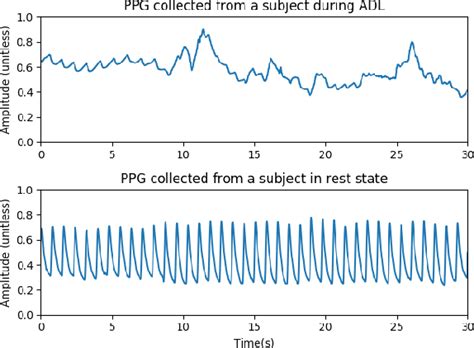 Photoplethysmography Ppg Models Code And Papers CatalyzeX