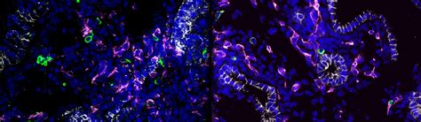 Immune Cells Shape Lung Before Birth And Offer Potential New Avenues
