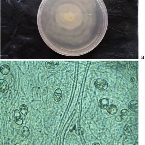 Currently I Am Working On Pythium And Phytophthora Spp Sajjad Hyder