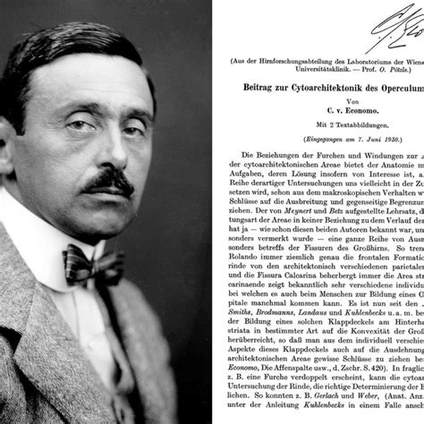 Cytoarchitectonics Of The Rolandic Operculum Morphofunctional Ponderings Request Pdf