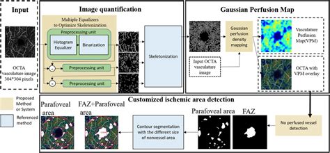 flowchart of the proposed automatic octa image analysis algorithm