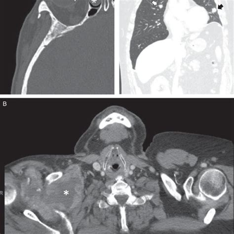 Summary Of The Choi Criteria Definitions Download Table