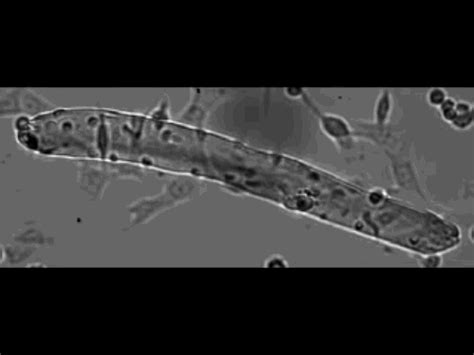 Genetic Engineering Optogenetics  Wiffle
