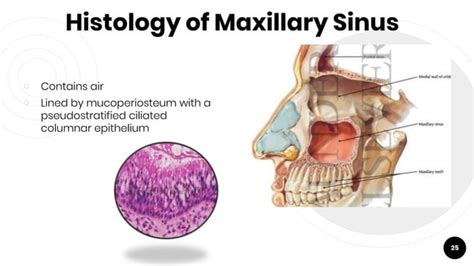 Maxillary Sinus Imaging Pptx Ear Nose And Throat Conditions