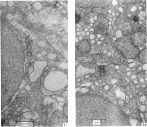 Figure 13 From Cilia And Centrioles Of The Rat Adrenal Cortex Semantic Scholar