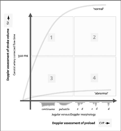 Figure 3 From Simultaneous Venous Arterial Doppler Ultrasound During Early Fluid Resuscitation