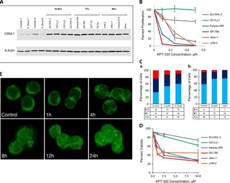 The Effect Of Crm1 Inhibition On Human Non Hodgkin Lymphoma Cells Pmc