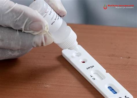 Affordable And Accurate Why Choose Indian Rapid Test Kit Manufacturers