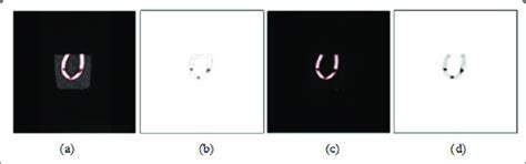 Iterative Segmentation Process Of Mri With Active Contour Model A 50