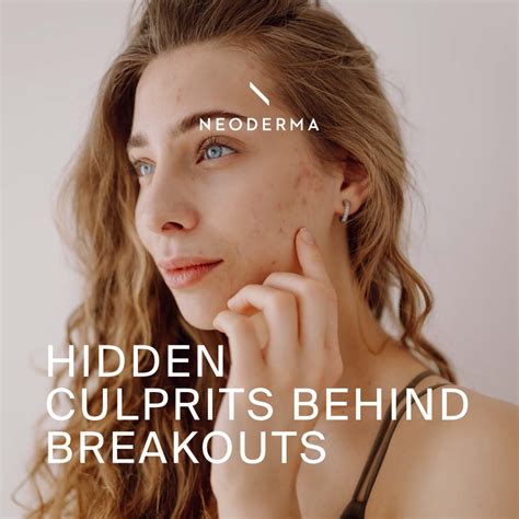 Hidden Culprits Behind Breakouts Neoderma