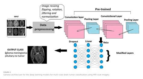 Figure 4 From A Fine Tuned Vision Transformer Based Enhanced Multi Class Brain Tumor