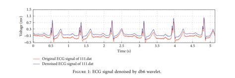 An Effective Lstm Recurrent Network To Detect Arrhythmia On Imbalanced