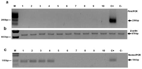 Screening Of Ebv In Breast Cancer Samples A Ten Representative Download Scientific Diagram