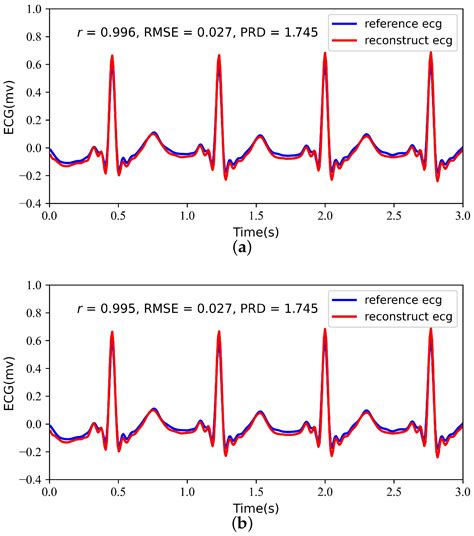 Subject Independent Model For Reconstructing Electrocardiography Signals From