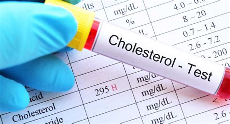 Cholesterol Test Understanding Your Blood Test Results Dr Sandra