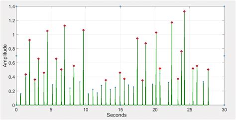 R Peaks Detection Based On Wavelet Transform With Expert Annotations Download Scientific Diagram