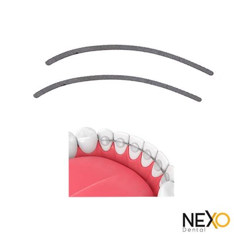 retenedor lingual universal nexo dental