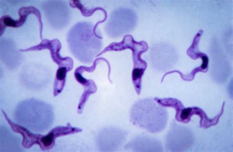 Trypanosoma Brucei Gambiense