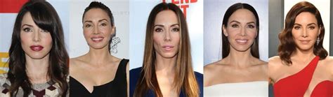 Celebrity Plastic Surgery Before And After 2023