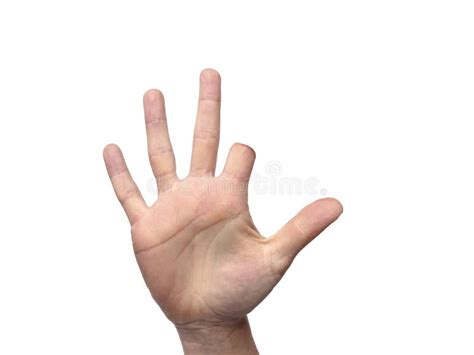 Thumb Amputation Injury