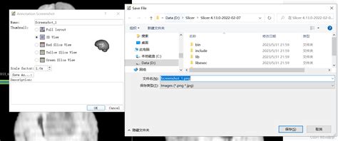 使用3dslicer软件渲染3d医学图像3d Slicer读取nii图像 Csdn博客