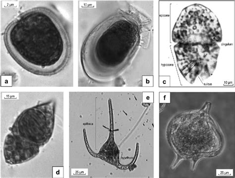 5 Representative Marine Planktonic Dinoflagellates A Prorocentrum