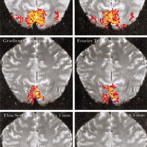 Activation Maps Of The Visual Cortex As In Fig 3 But For A Different
